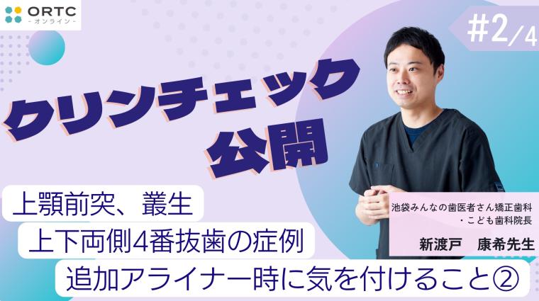 上顎前突、叢生、上下両側4番抜歯の症例、追加アライナー時に気を付けること2｜ORTC歯科医療者向けセミナー&動画学習サイト